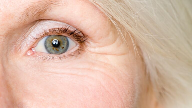 Common Age Related Eye Problems and Treatment Options